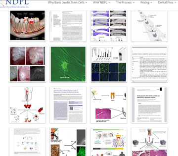 National Dental Pulp Laboratory Dental Pulp Stem Cell Research Library